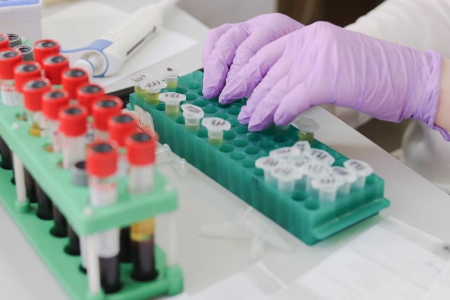 Αιματολογικές Εξετάσεις στη χορτοφαγία | Plantbased.gr